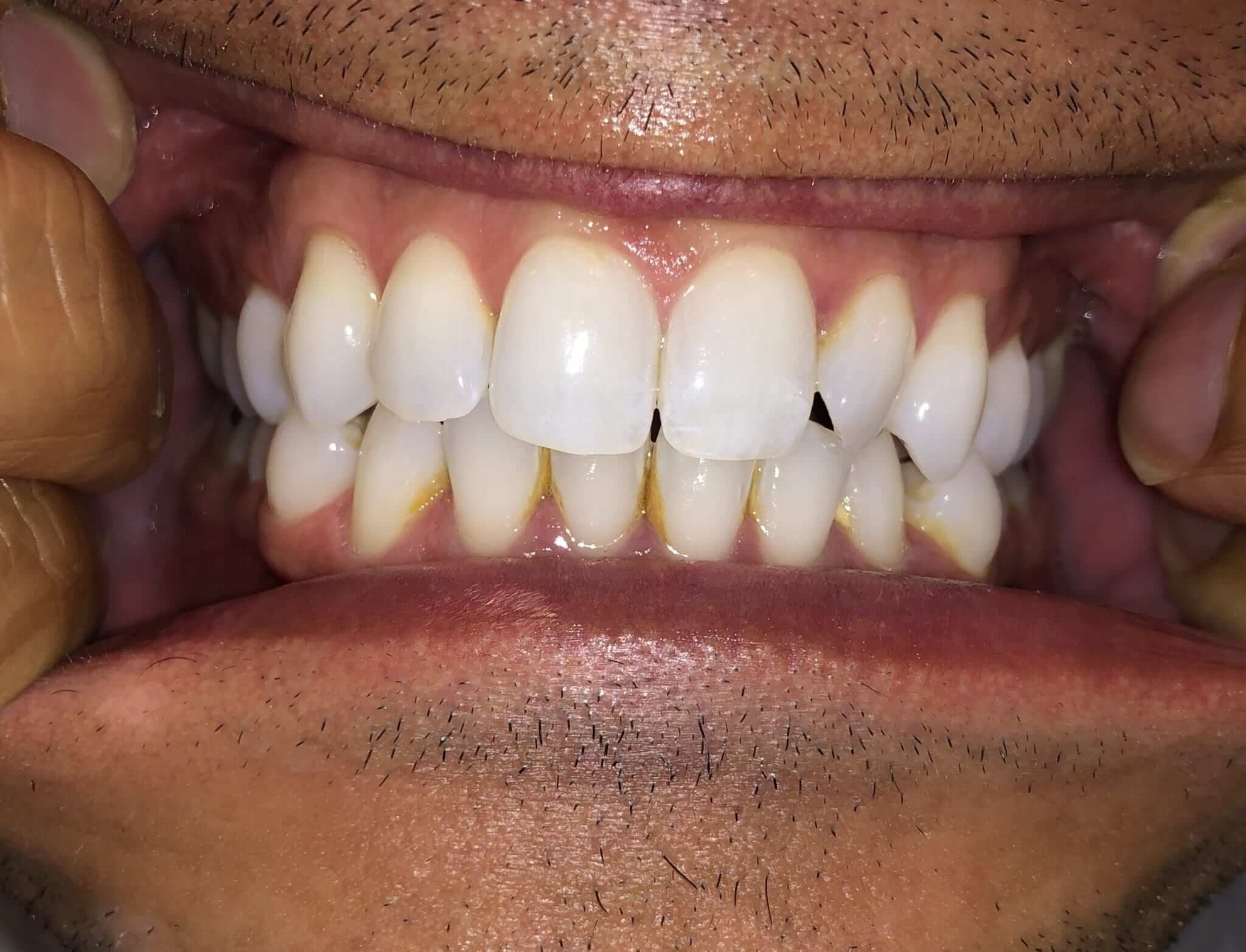 How to take photos | Smile Spa%